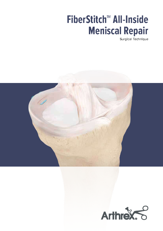 Arthrex - Helping Surgeons Treat Their Patients Better™