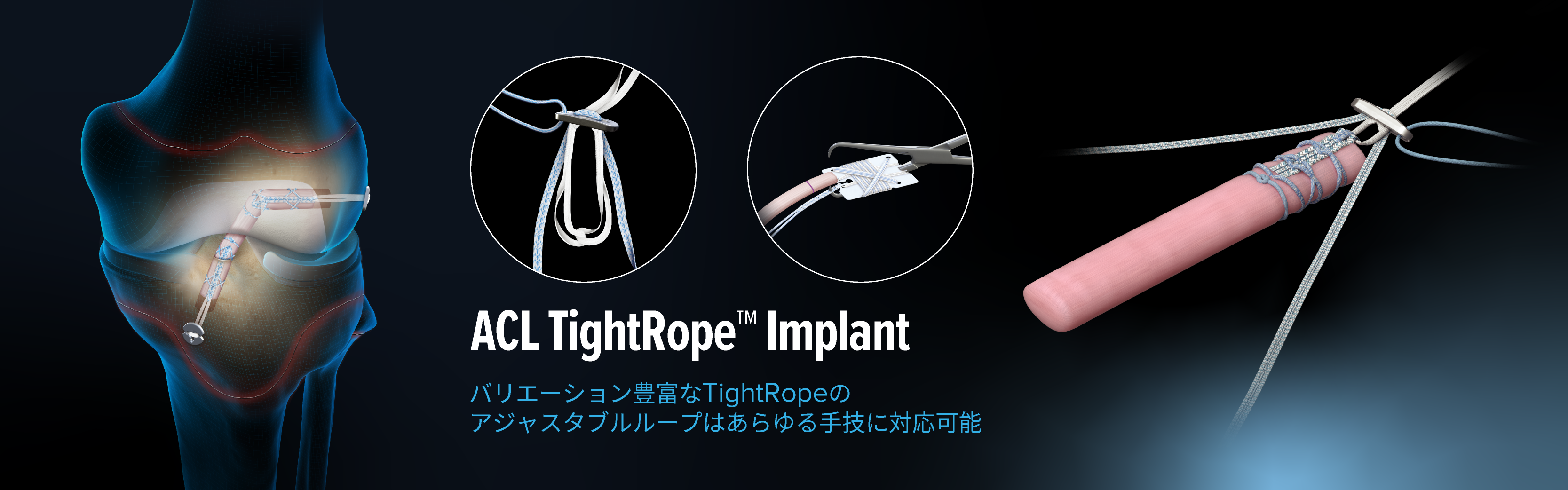 Arthrex - Helping Surgeons Treat Their Patients Better™